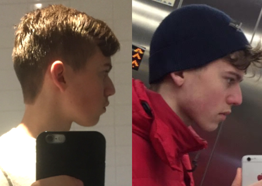 Stronger Gum - #1 Jaw Exerciser | Jawline Chewing Gum